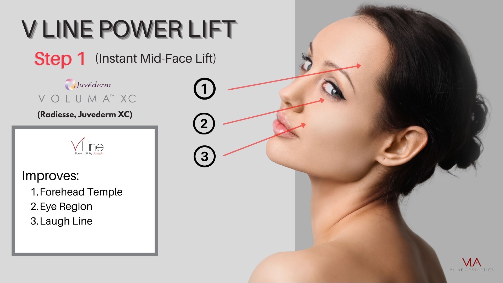 Non-surgical Face Lift - V LINE AESTHETICS