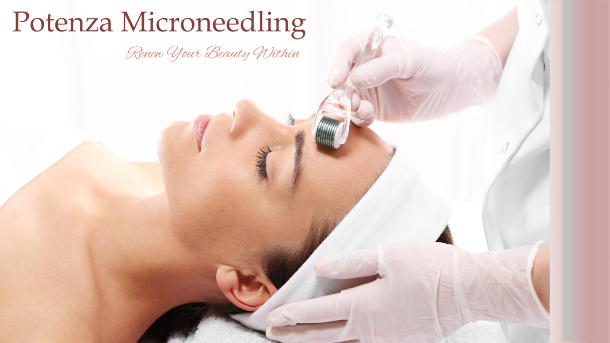 Reductions with Potenza Microneedling - V LINE AESTHETICS