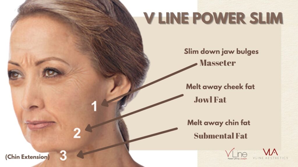 A Quick Overview - V LINE AESTHETICS