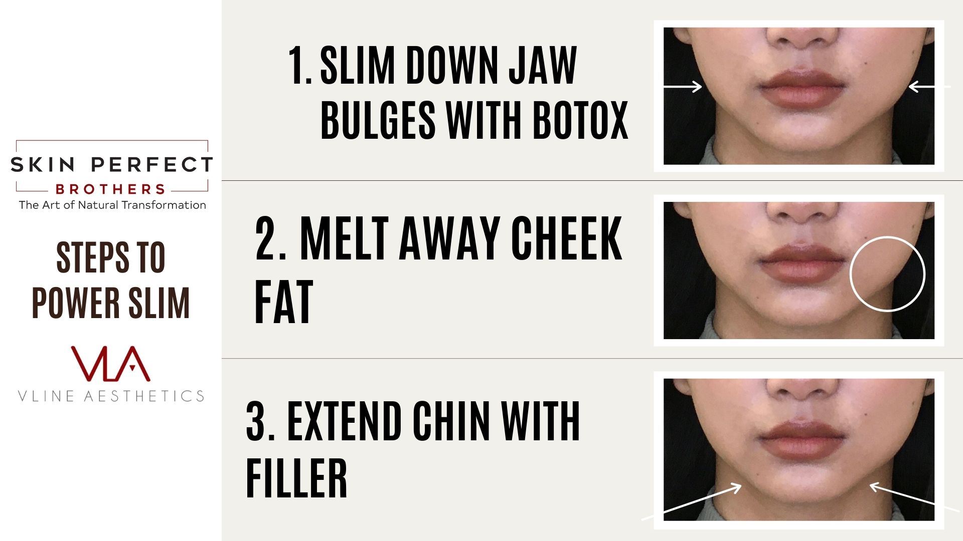 My Solutions - V LINE AESTHETICS