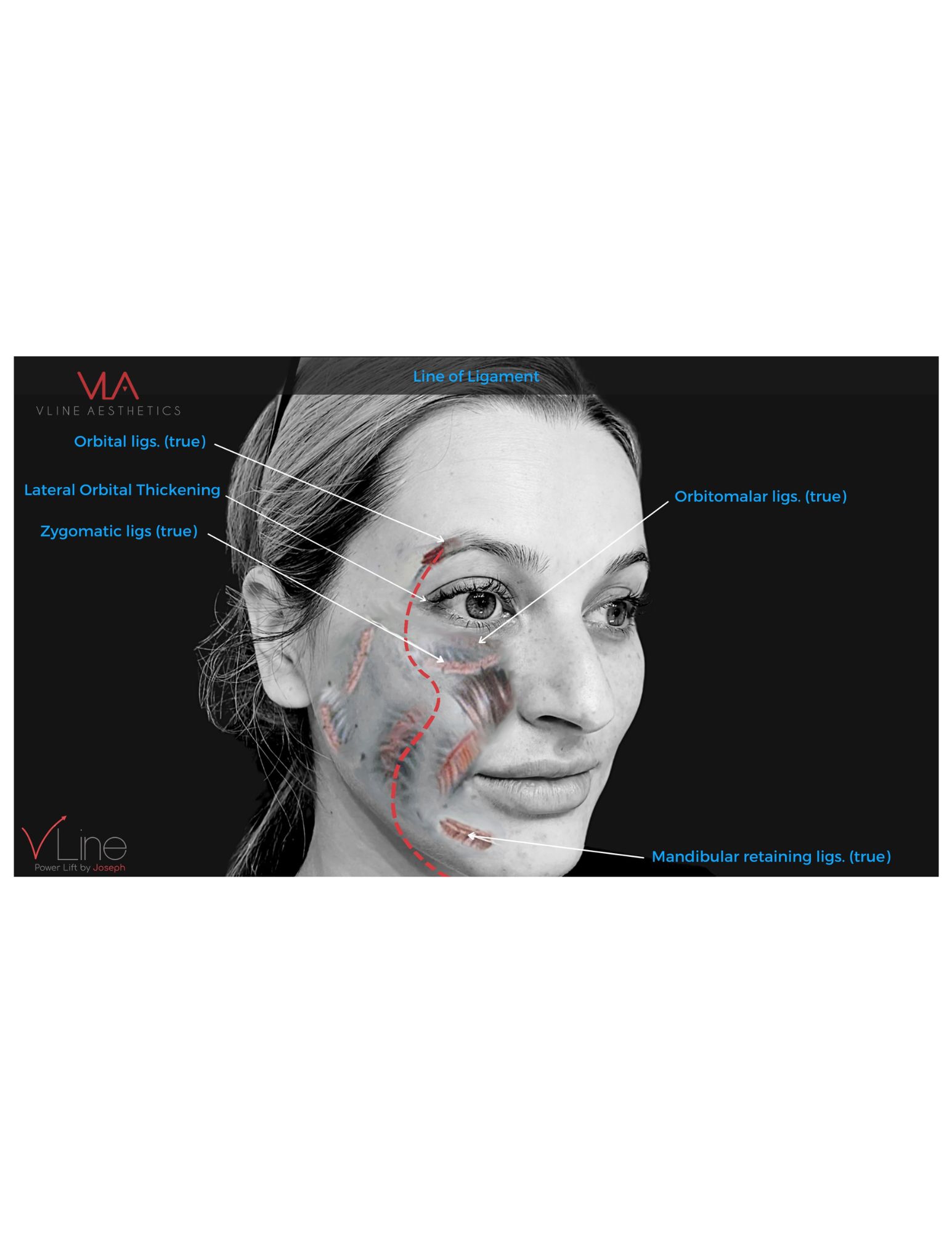 Anatomy Book 1 - V LINE AESTHETICS
