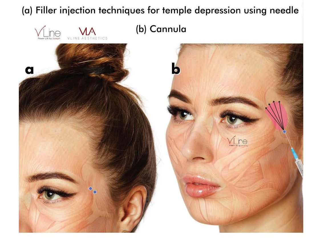 Anatomy Book 2 - V LINE AESTHETICS