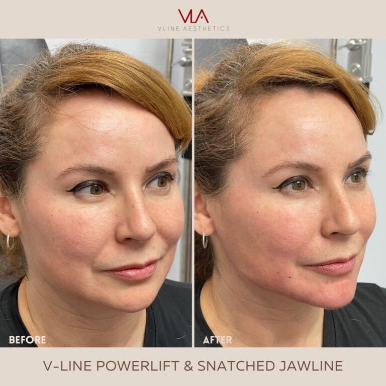 Home - V LINE AESTHETICS